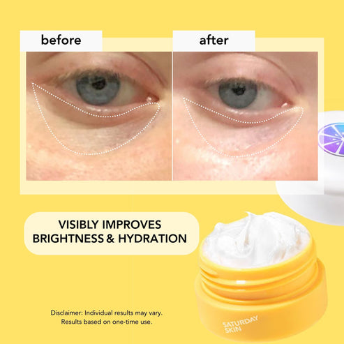 Yuzu Eye Cream with Vitamin C & Retinol | Korean Skincare – Saturday Skin